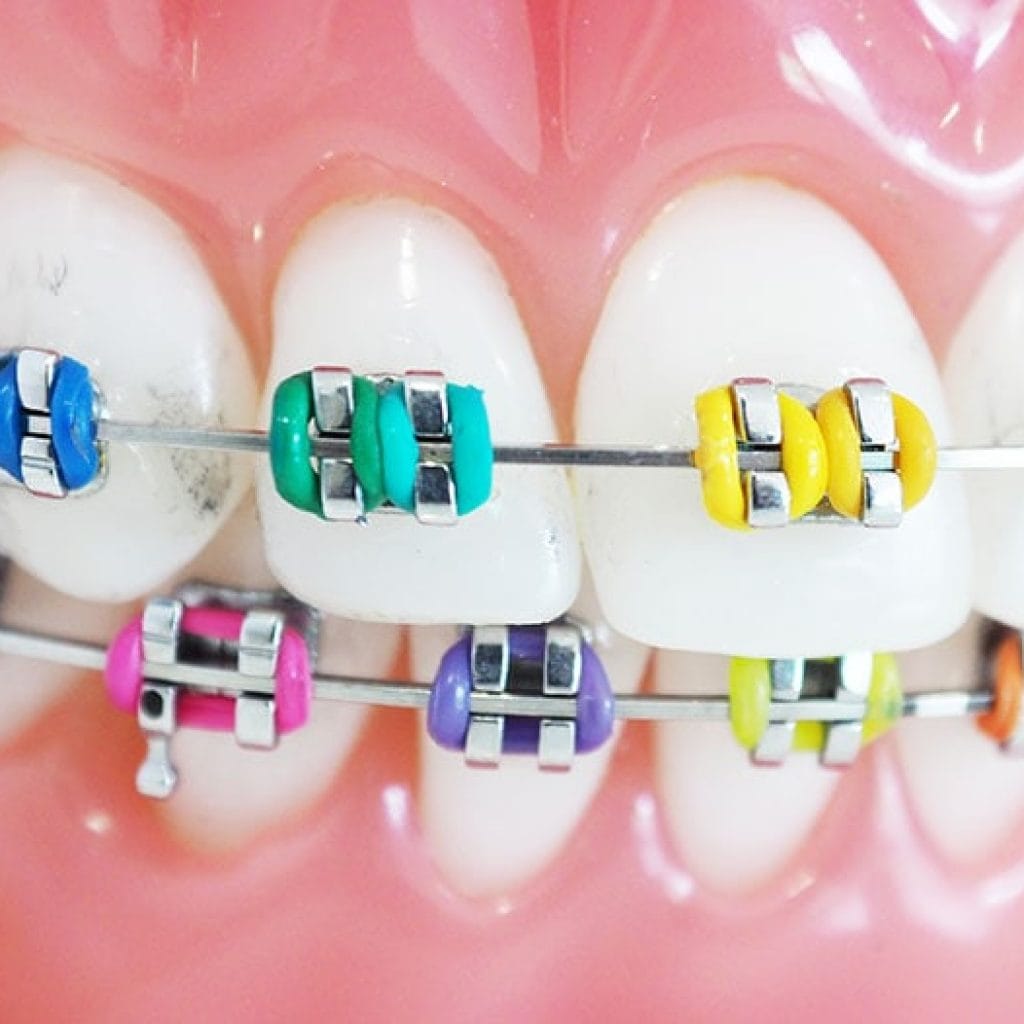 Cosmetic Dentist Las Vegas - Nevada Dentistry & Braces